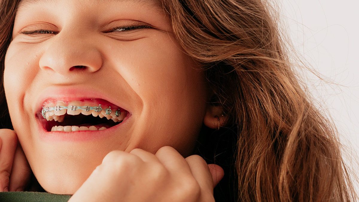 Tratamiento de ortodoncia en Santander | Clínica Dental Palacio